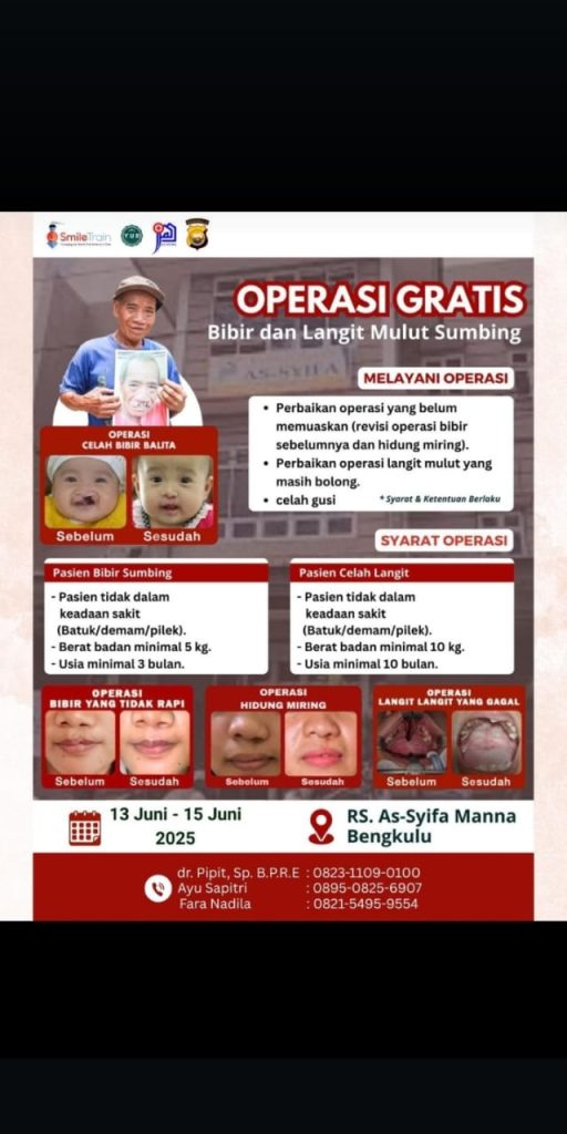 Operasi Gratis Bibir Dan Langit Mulut Sumbing Di RS As-syifa Manna Bengkulu Selatan – Kompas News